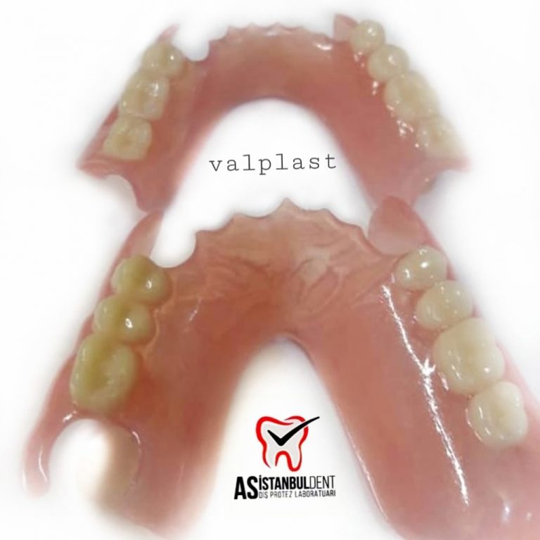 Deflex Çalışmalar - Asistanbul Dent Dijital Diş Laboratuvarı